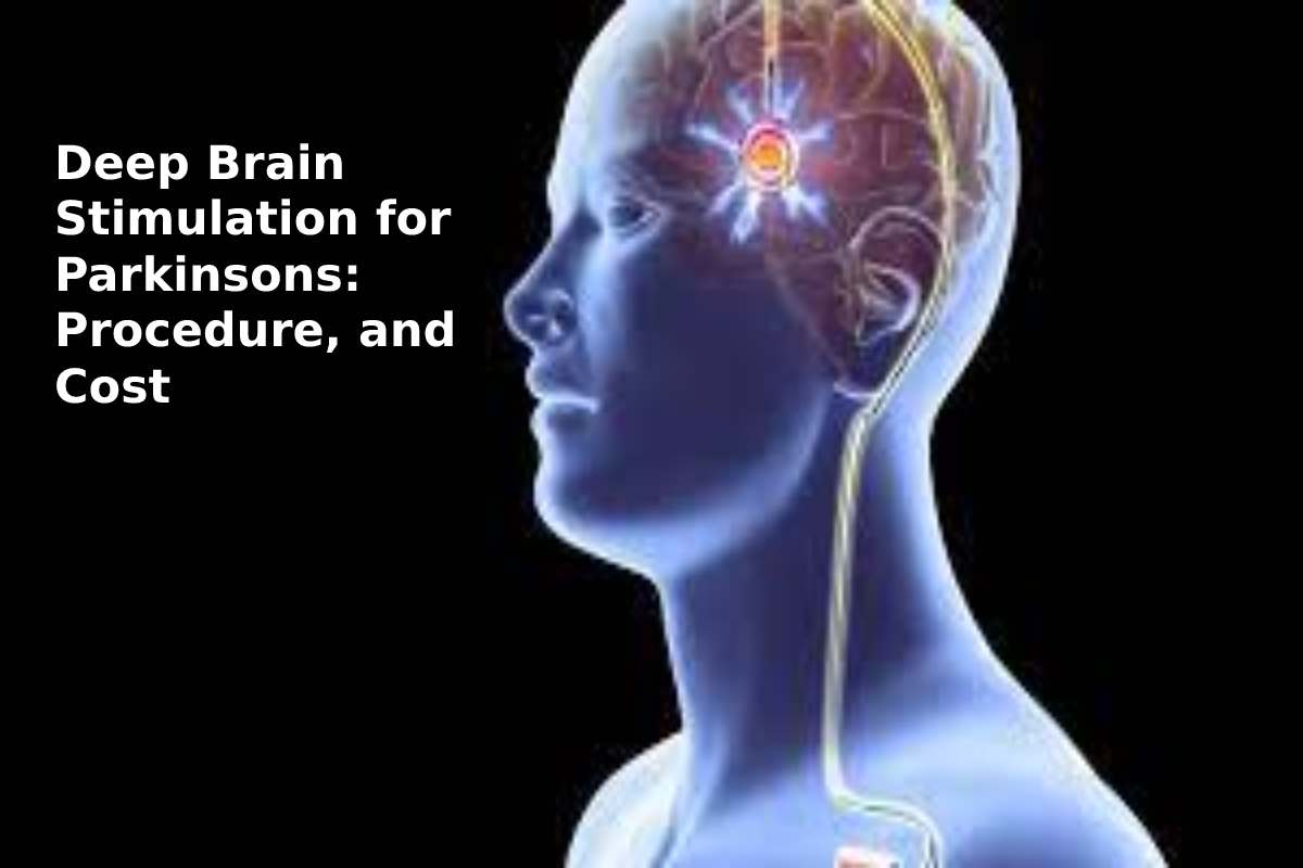 Deep Brain Stimulation For Parkinsons Procedure And Cost 2021 Deep Brain Stimulation For Parkinsons Procedure And Cost 2021